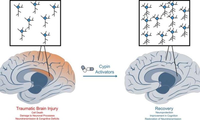 Traumatic brain injury: Discovery of two molecules could lead to new ...