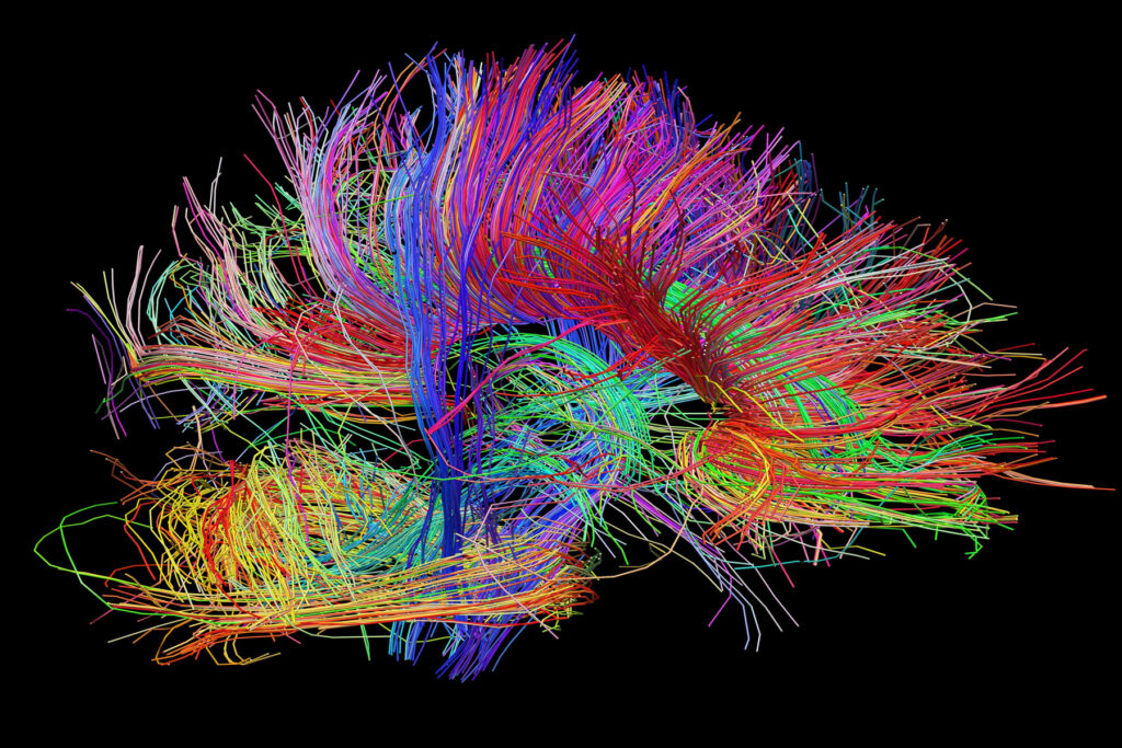 Researchers Create Maps of the Brain After Traumatic Brain Injury - San ...